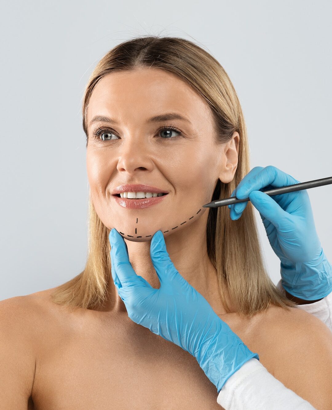 Rhinoplastie Structurelle et conservatrice - Génioplastie